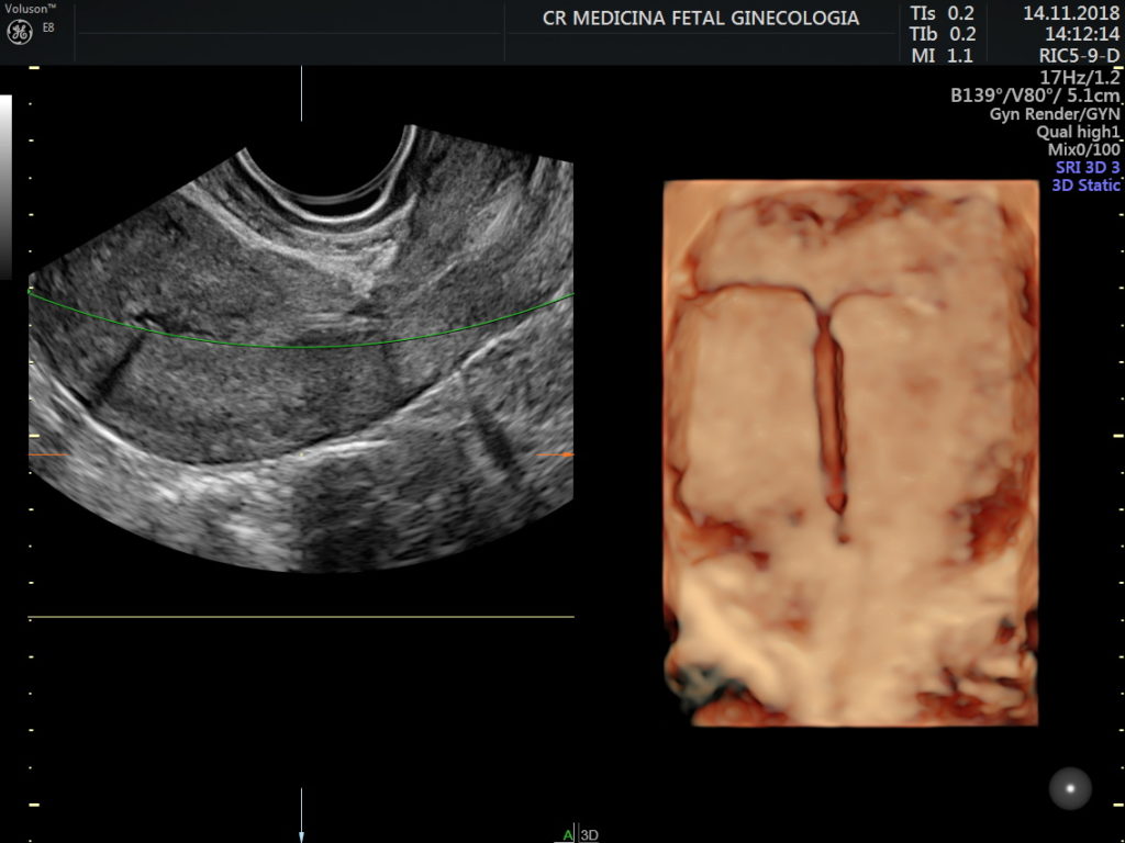 POSIÇAO DIU – CR Medicina Fetal